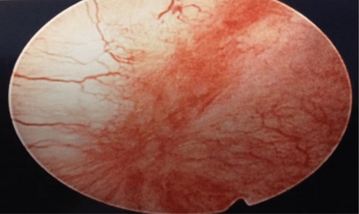 Female Urology Specialist In Nashik | Dr. Pravin Govardhane